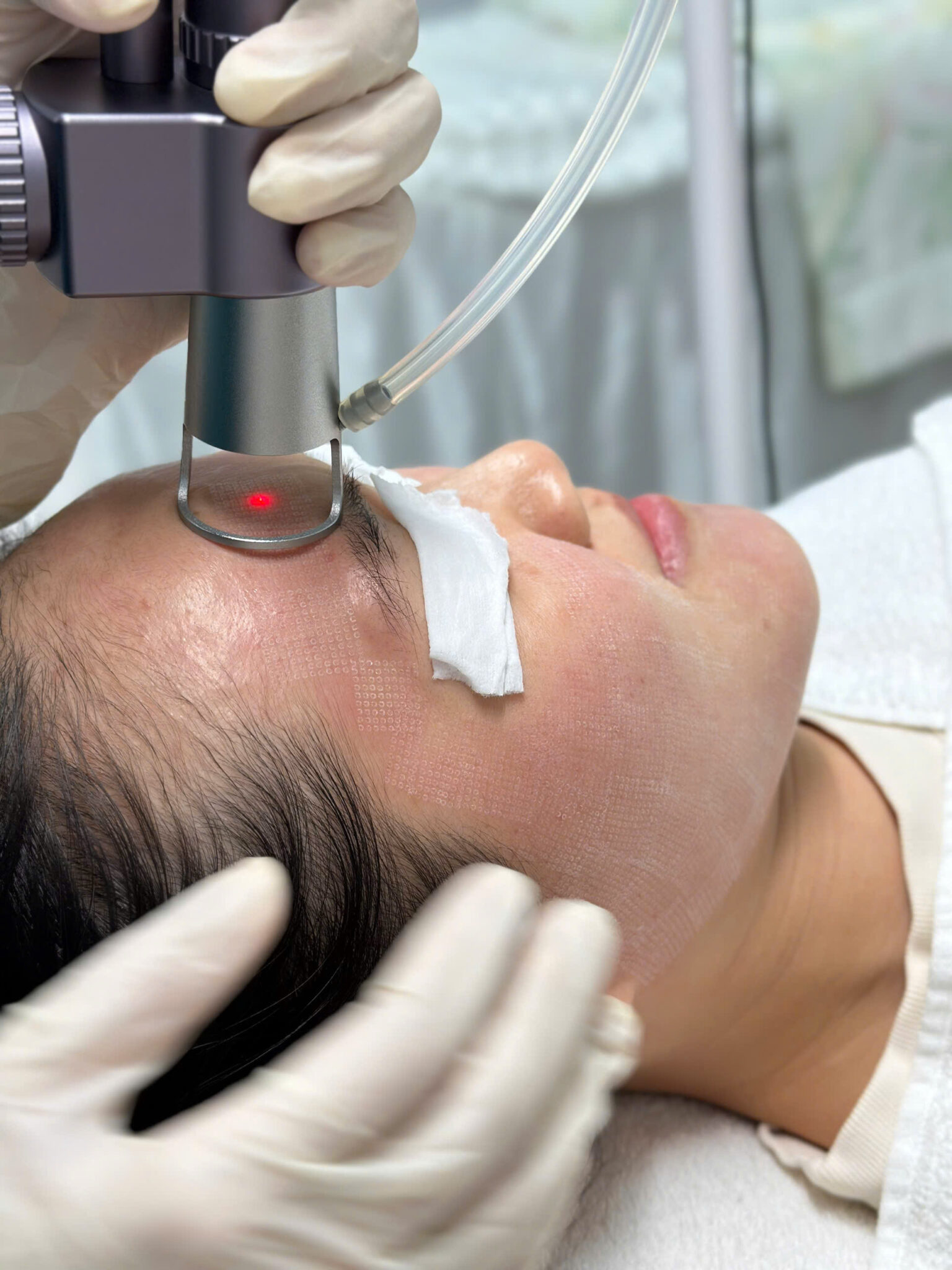 ISOV sau laser - Phục Hồi Da Sau Laser Hiệu Quả - ISOV Sorex Việt Nam ...